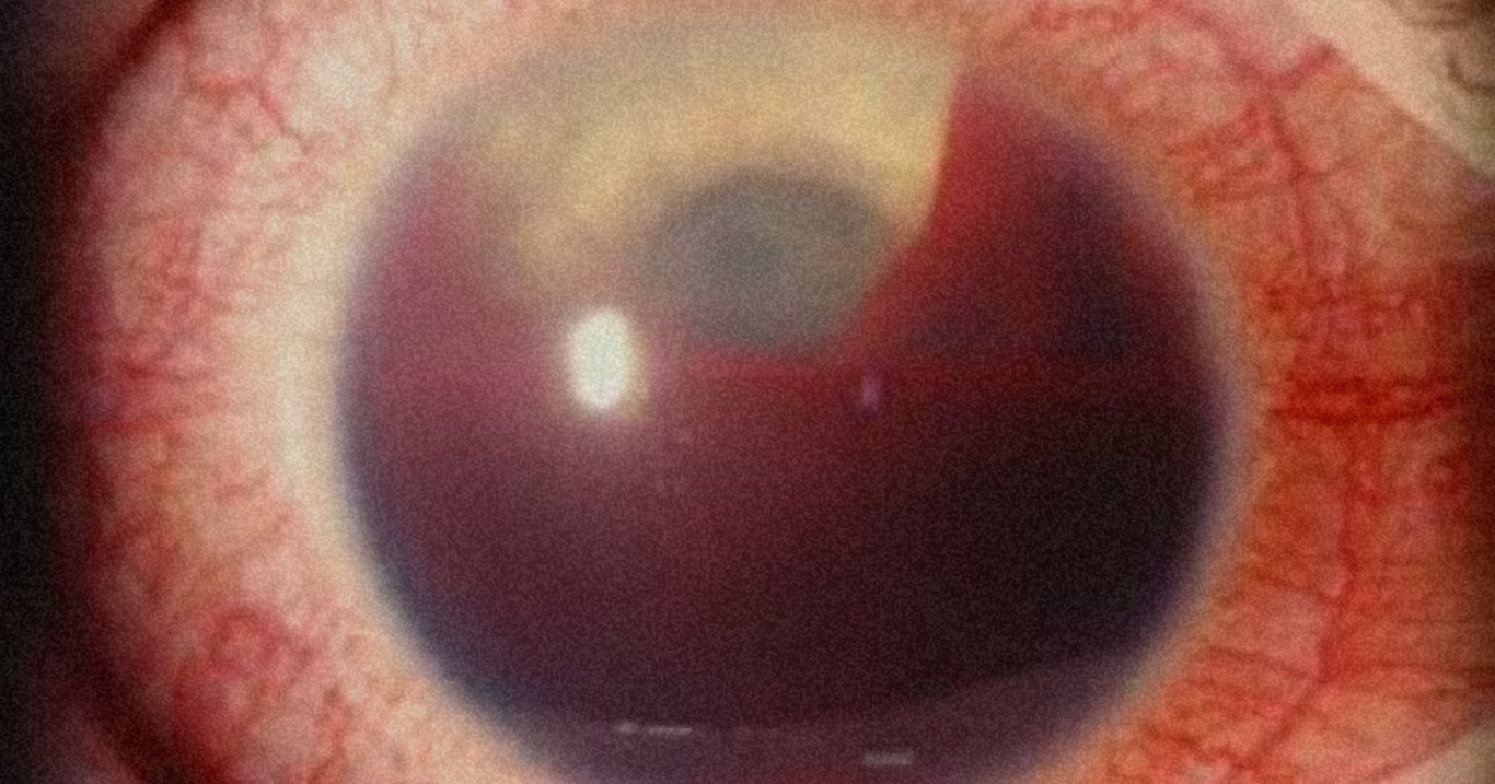 Ocular Emergencies Summit 2025 | Woo University