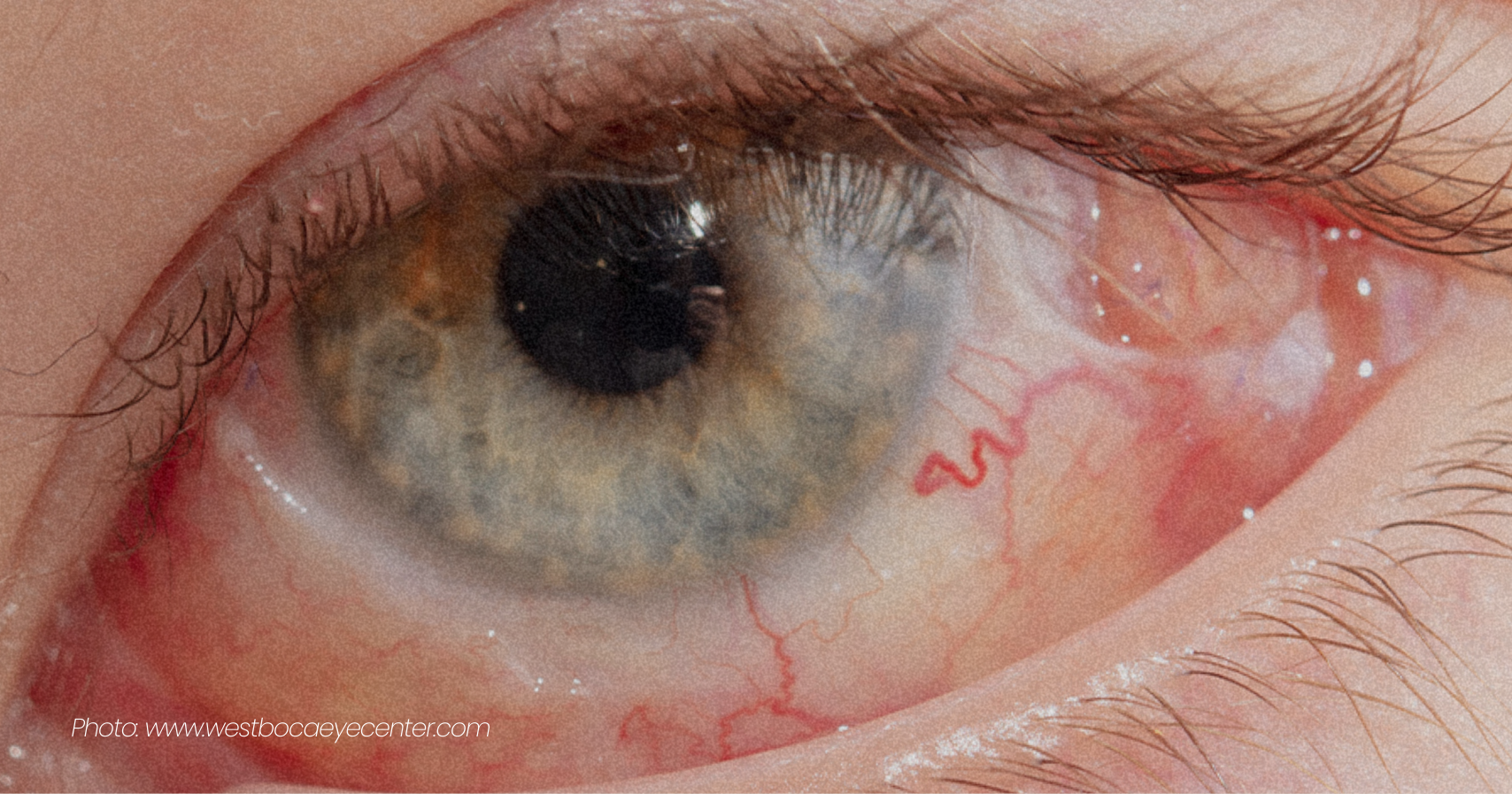 Ocular Emergencies Summit 2025 | Woo University