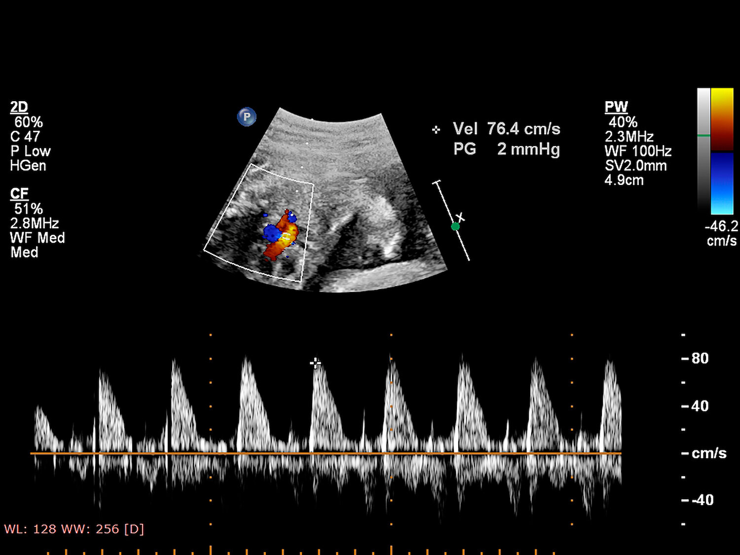 Ultrasound Service in Kingston - PRIME Medical & Radiology