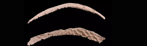 Syphilis Originated in the Americas, New DNA Evidence Confirms