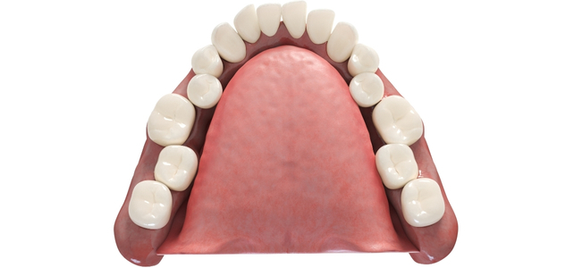 Origins of Dental Braces Aren't as Ancient as We Once Thought