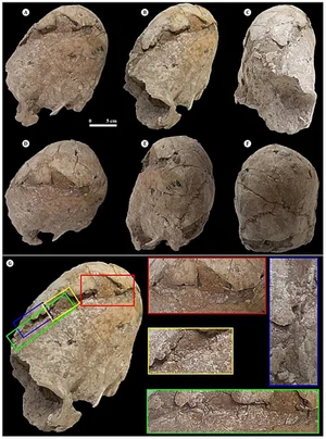 Teen Girl with Cone-Shaped Skull Unearthed in Ancient Iranian Cemetery ...