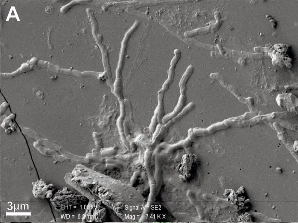 Scientists Discover Intact Brain Cells After Studying Victims of Mount ...