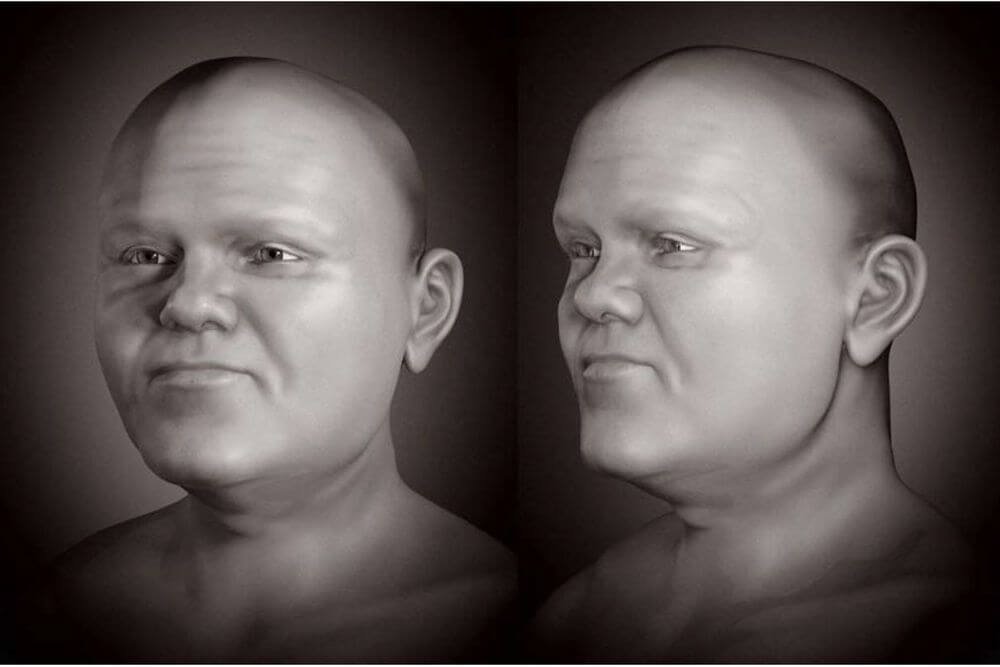 Recreating the Appearance of a Medieval Achondroplastic Dwarf with 3D ...
