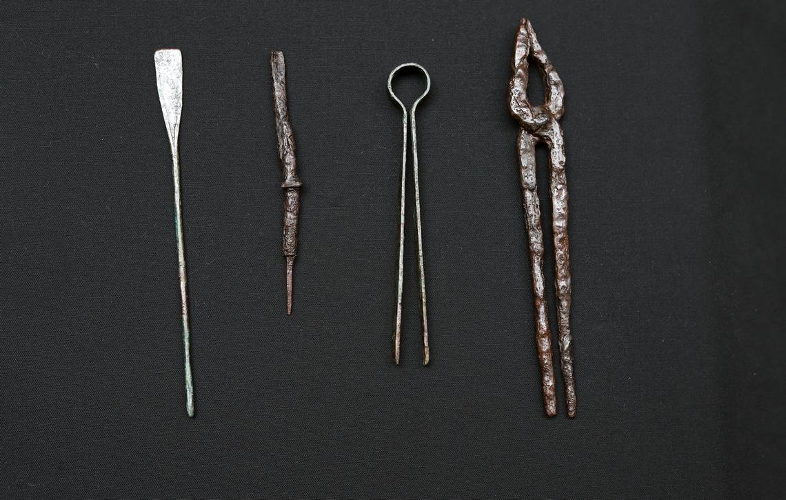 An ancient Roman physician traveled mysteriously to Hungary. Photos ...