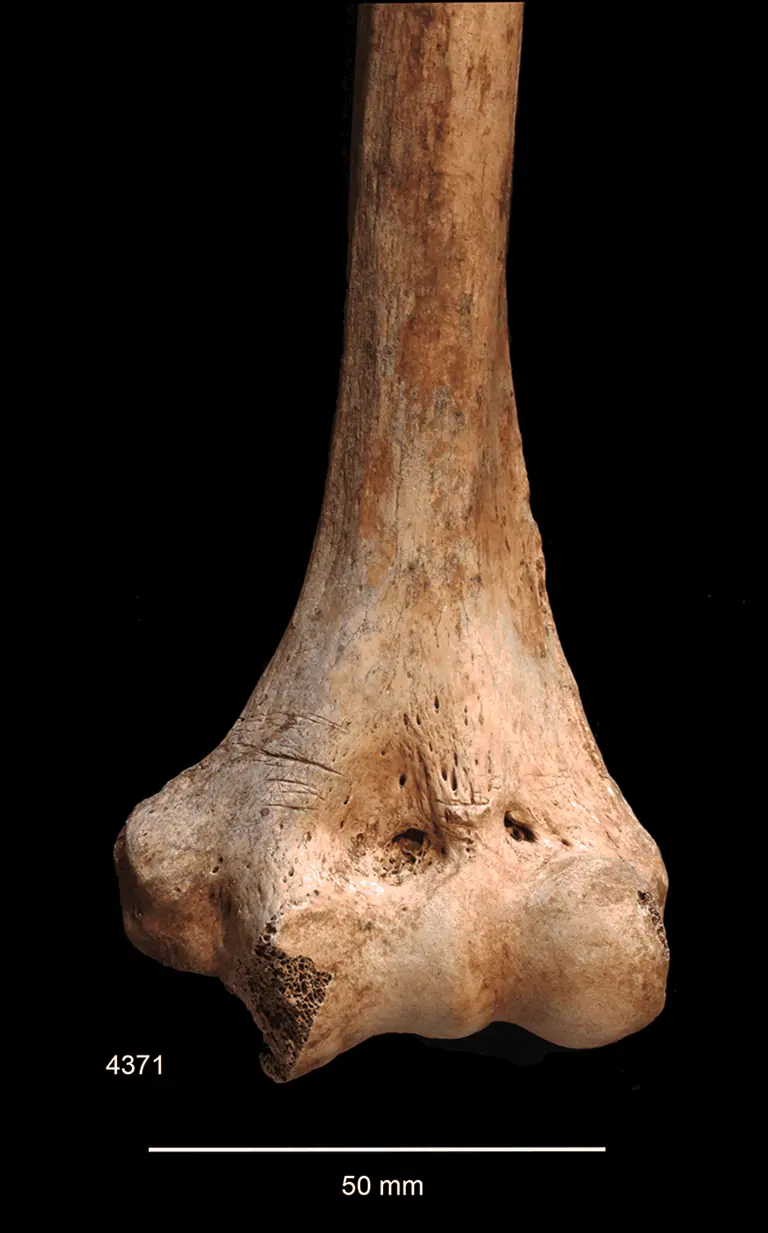 A Shocking Discovery: Britain’s Bloodiest Prehistoric Massacre
