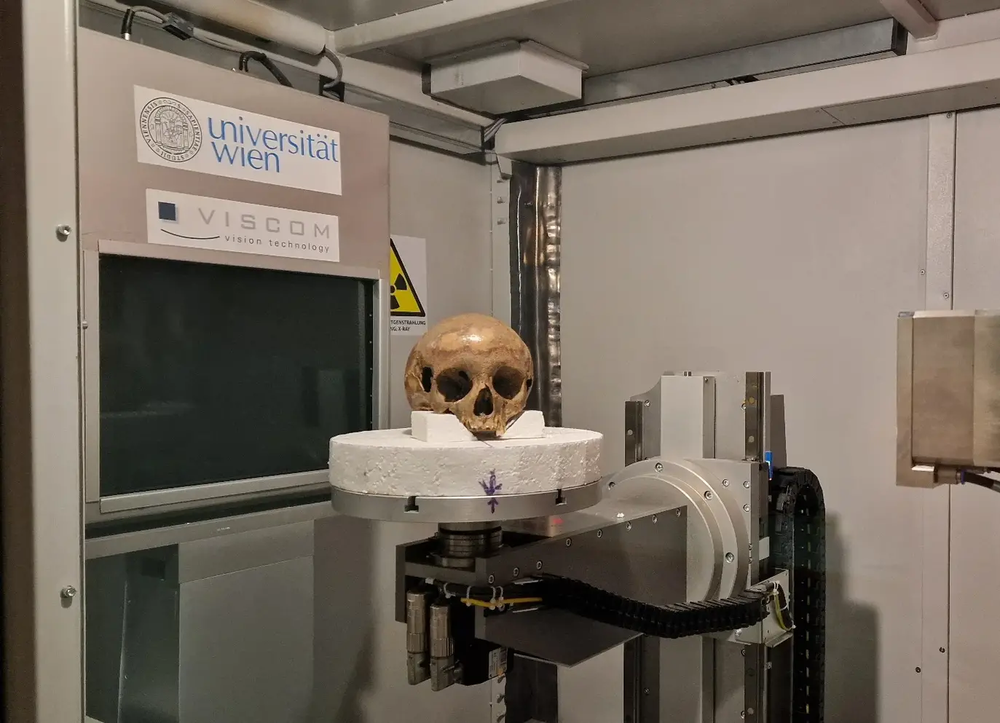 Scientific Breakthrough: Analysis of Ancient Skull in Ephesus