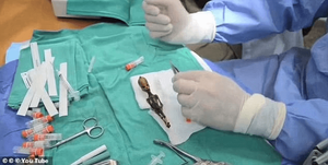 The Enigma of Chile's Atacama Skeleton: Ancient Human or ...