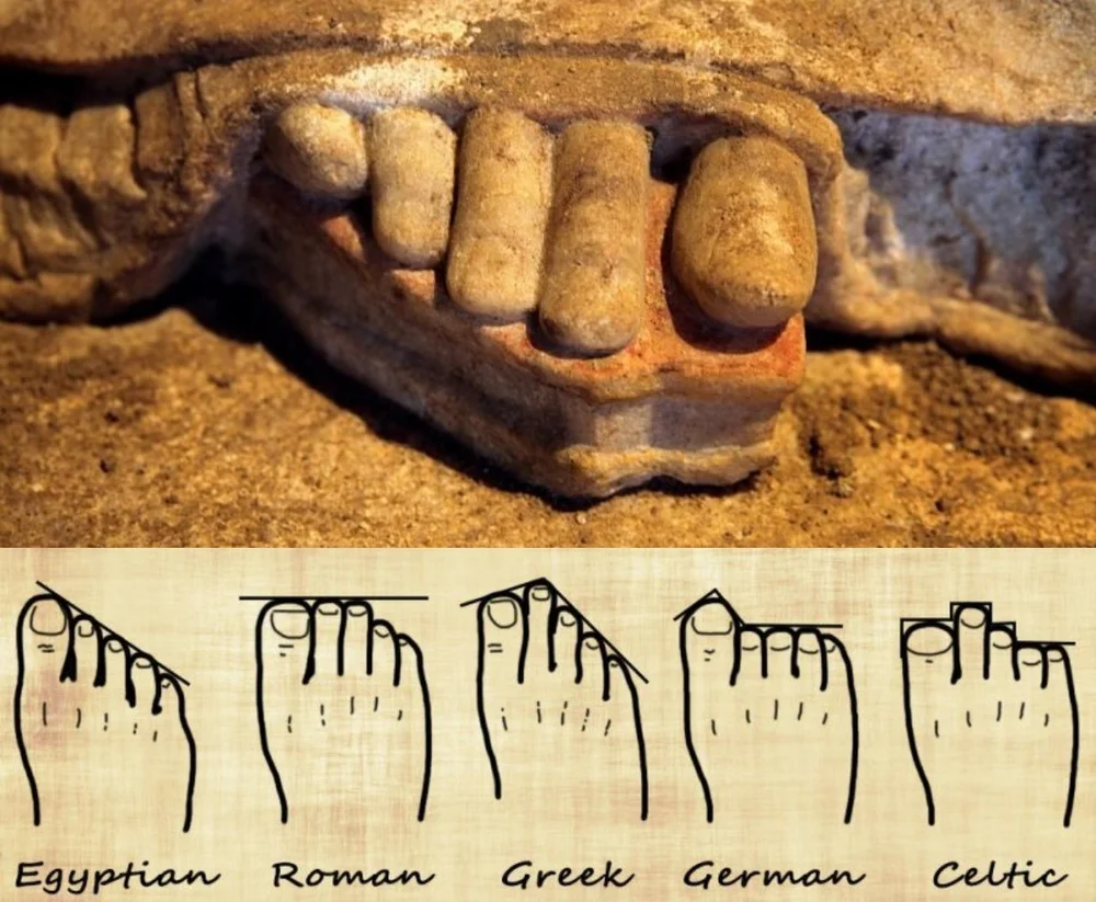 The "Greek Toe" of the Caryatids: Can Your Feet Reveal Your Greek Ancestry?