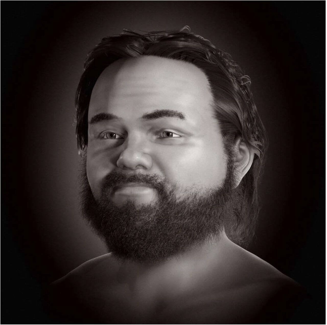 Recreating The Appearance Of A Medieval Achondroplastic Dwarf With 3d