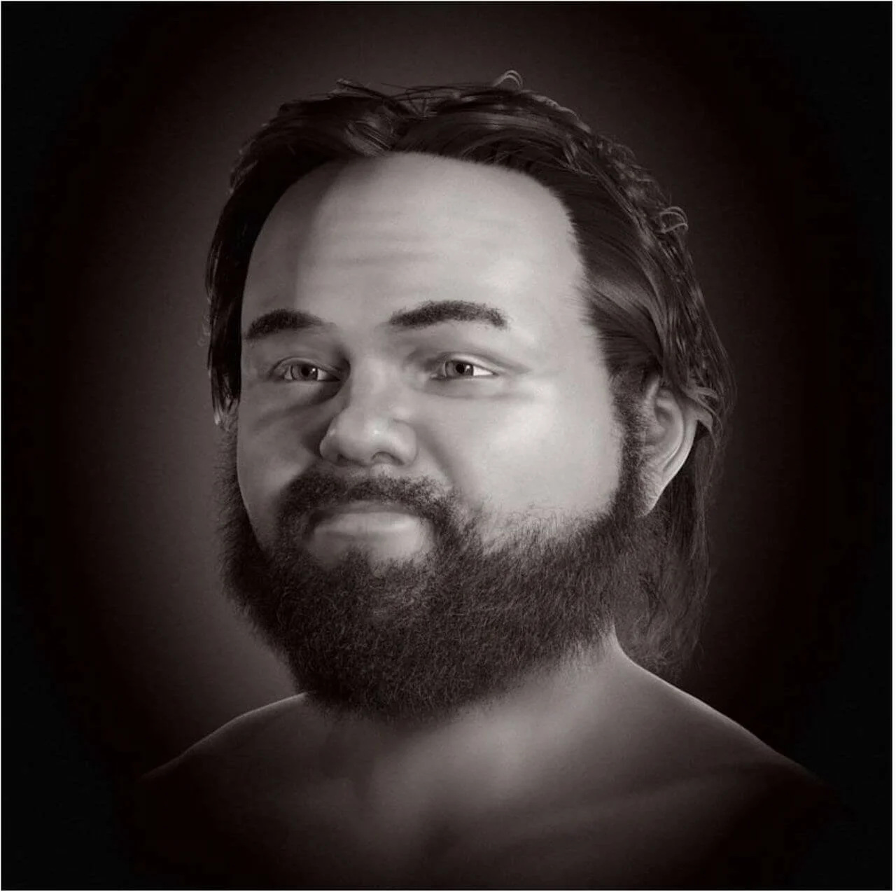 Recreating the Appearance of a Medieval Achondroplastic Dwarf with 3D ...