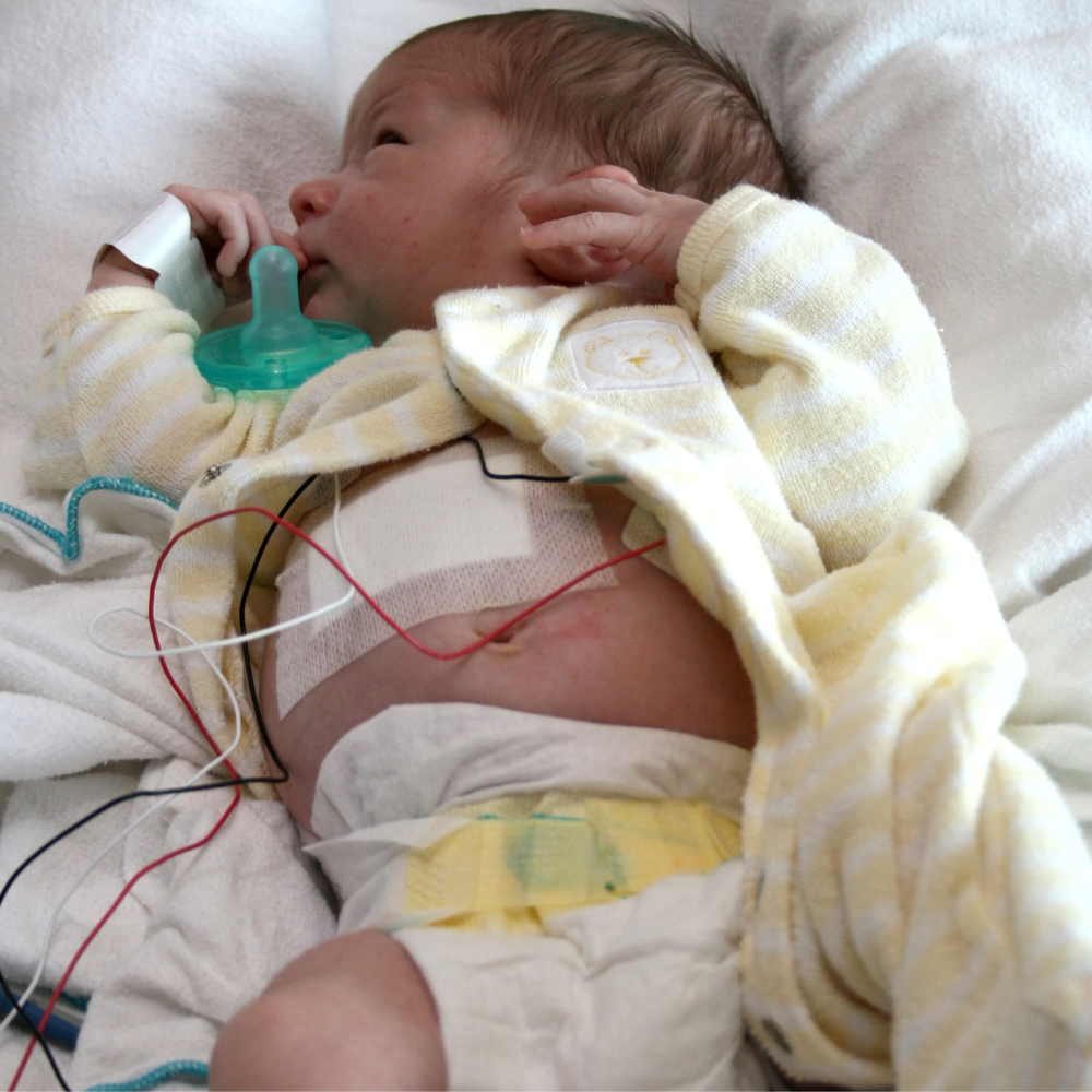 Beyfortus: a simple explanation for parents — THE PEDIATRICIAN MOM