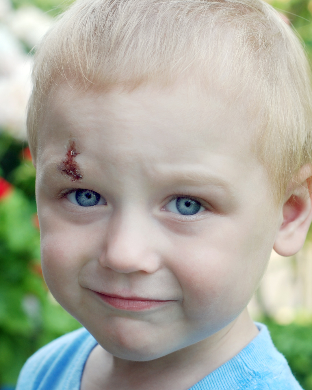 How to minimize scars in kids — THE PEDIATRICIAN MOM