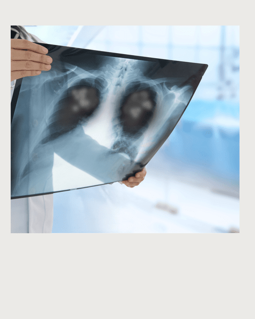 Pneumonia in kids and babies — THE PEDIATRICIAN MOM