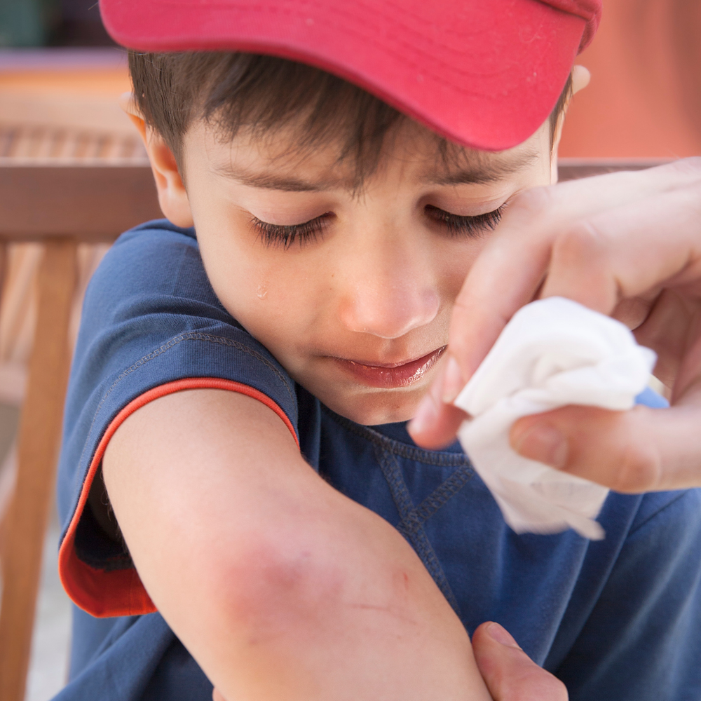 The correct way to fix wounds in kids — THE PEDIATRICIAN MOM
