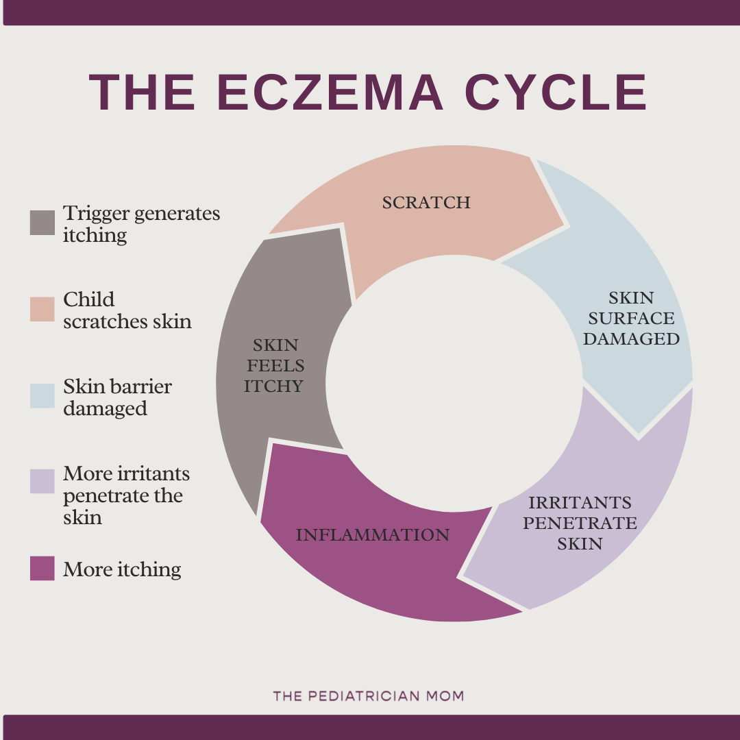 Eczema: triggers and grading — THE PEDIATRICIAN MOM