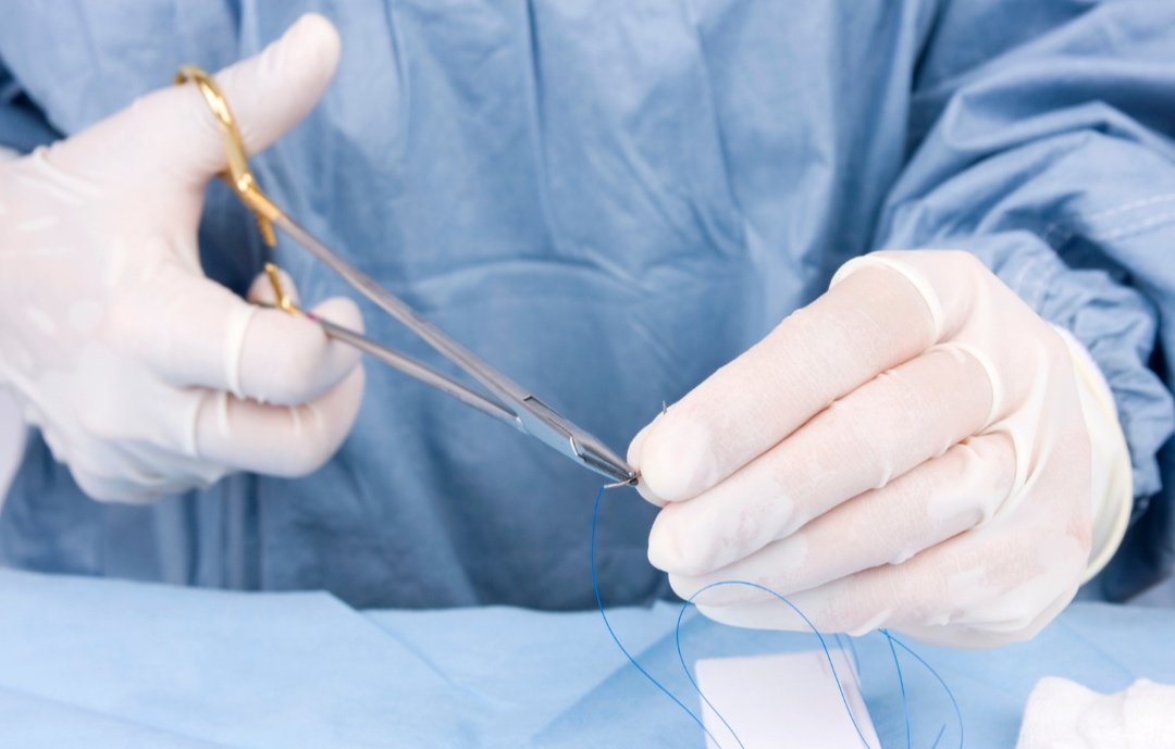 How to figure out if your child needs stitches — THE PEDIATRICIAN MOM