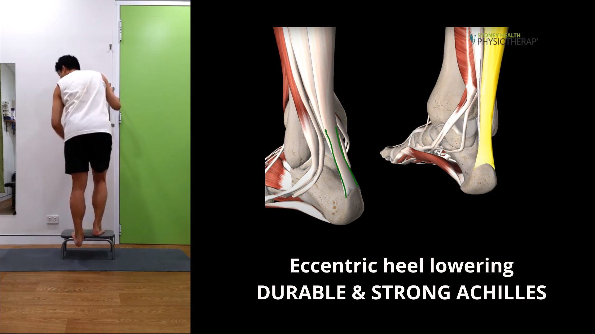 calf — Sydney Health Physiotherapy Exercises & Resources — Sydney ...