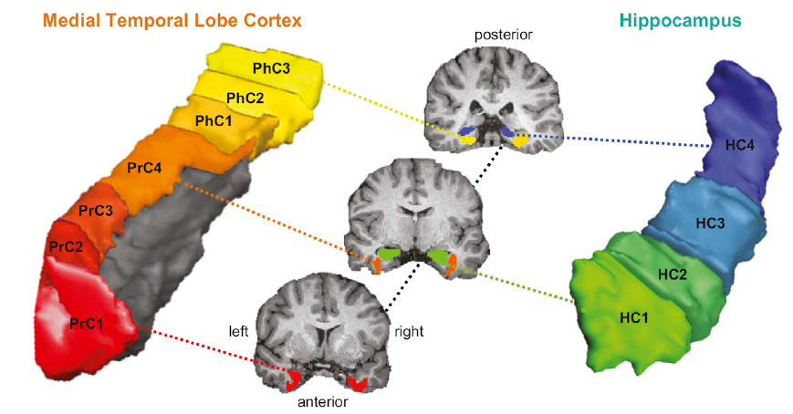 Projects — Martin Memory Lab