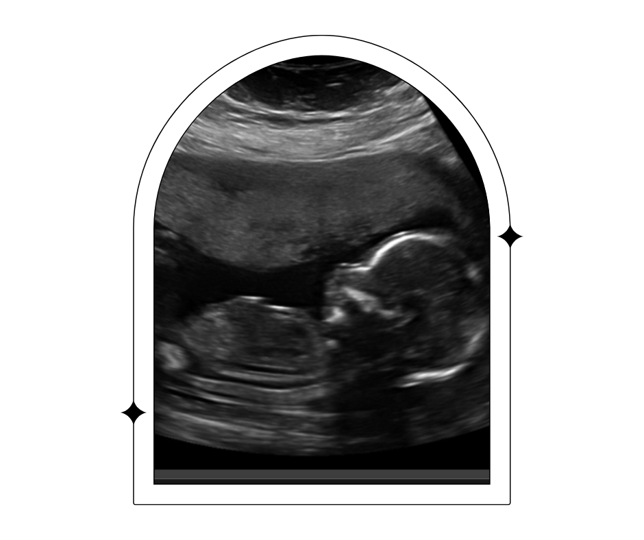 Imaging Miracles Prenatal Ultrasound Studio