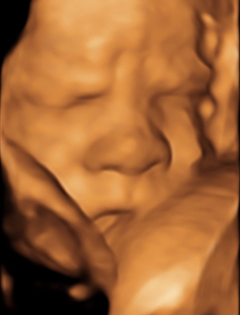 Imaging Miracles Prenatal Ultrasound Studio