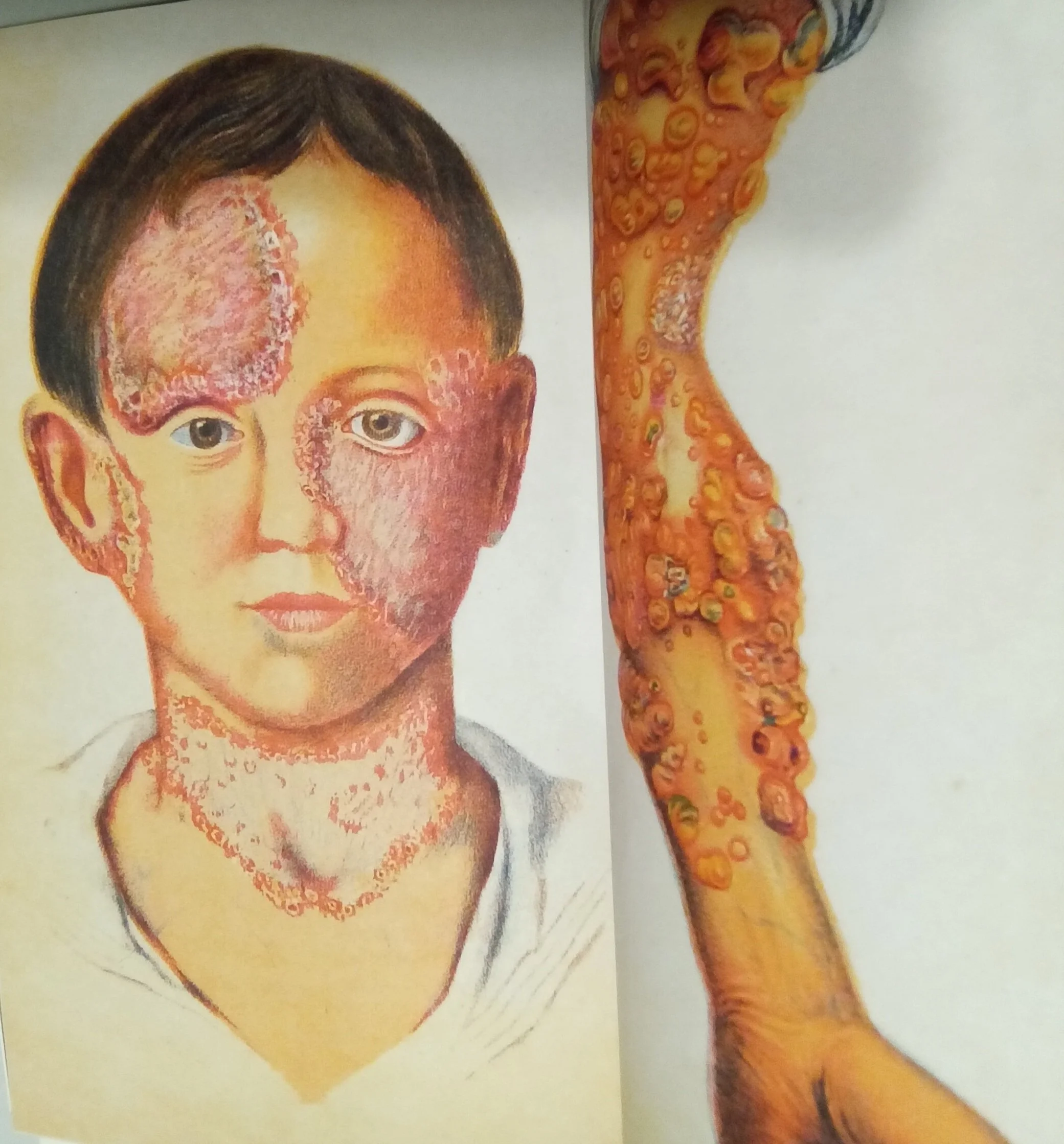 Infected by Art: Volume 1 — Joe the Tattoo Guy