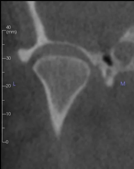 TMJ — AIRE Dental Group