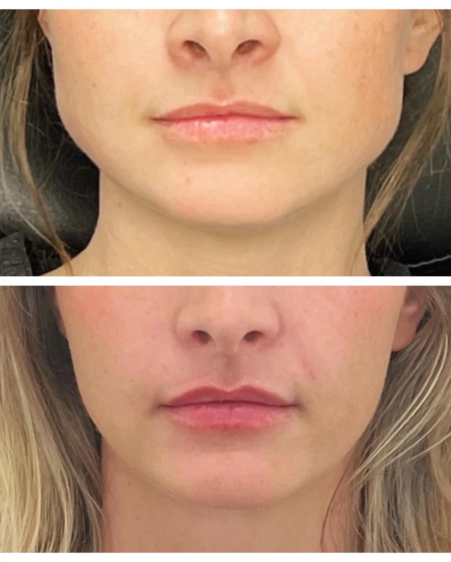 Chicago's Botox Med Spa — Opulence Chicago | Med Spa