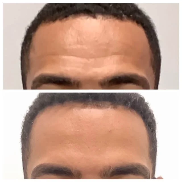 Chicago's Botox Med Spa — Opulence Chicago | Med Spa
