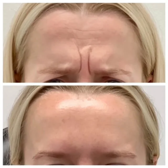 Chicago's Botox Med Spa — Opulence Chicago | Med Spa