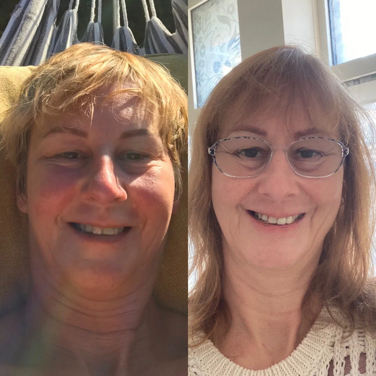 Before and After Alcohol — Sobertown Podcast | Sobriety Podcast ...