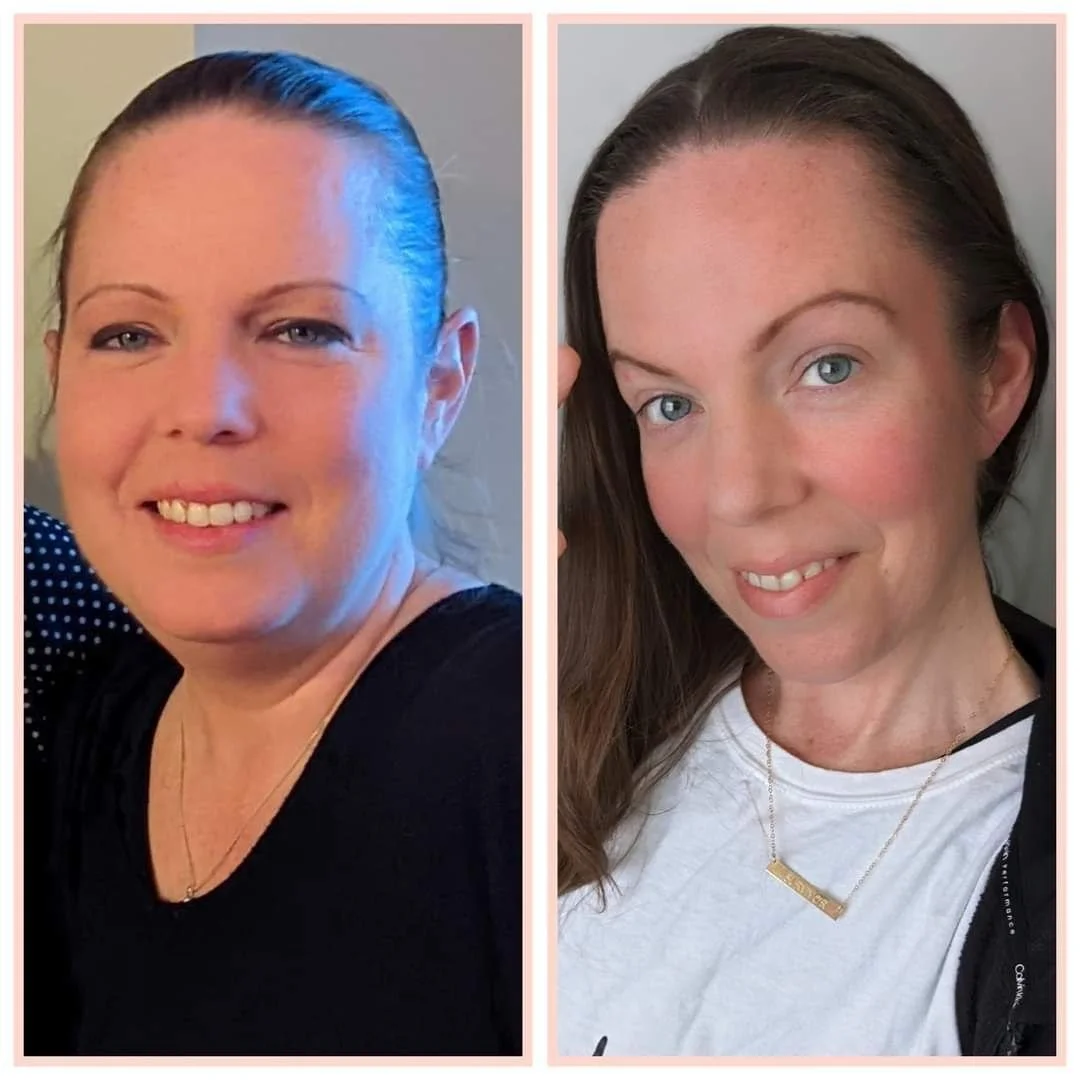 Before and After Alcohol — Sobertown Podcast | Sobriety Podcast ...