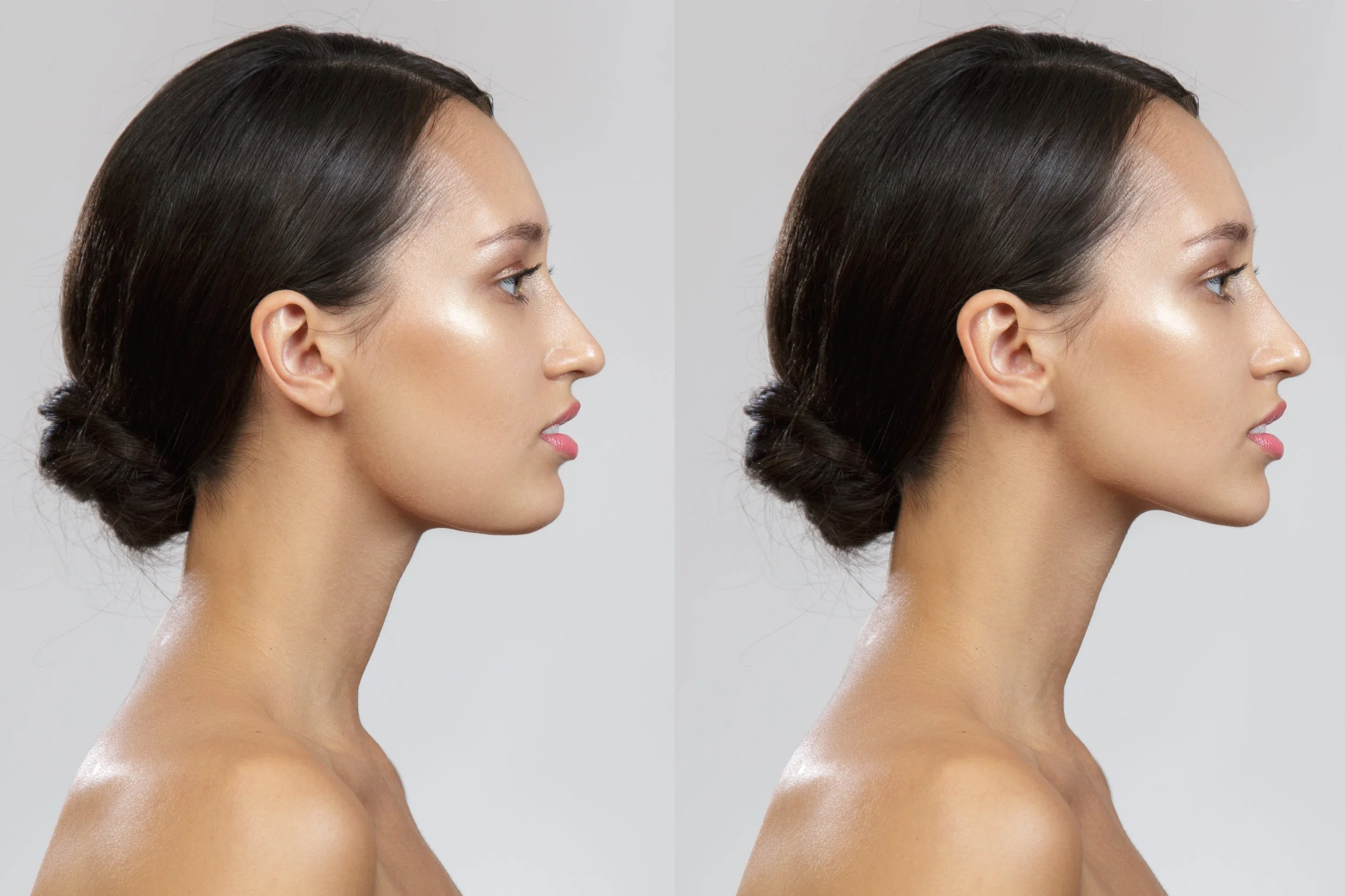 In Depth: What is Orthognathic Surgery and Would You Benefit From it ...