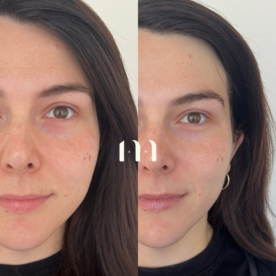 Meraki Beauty and Wellness