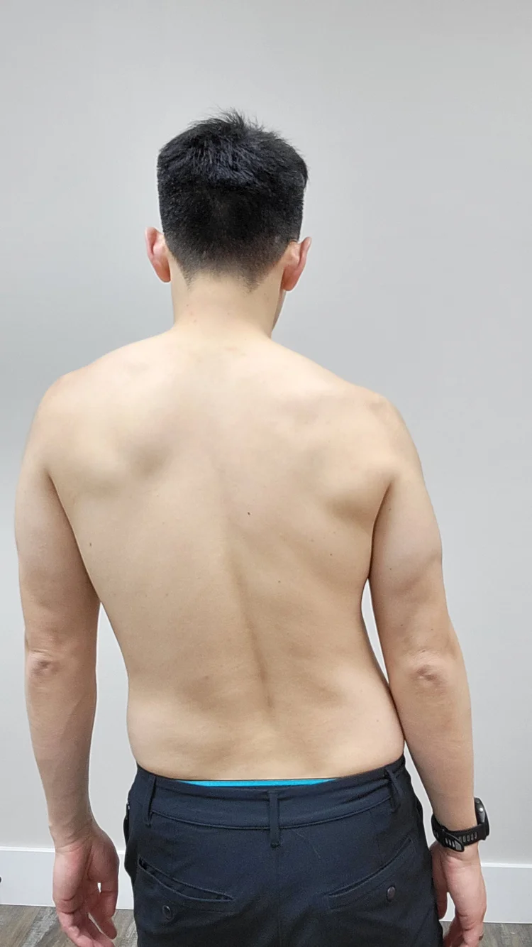 What to do with a Shifted Spine — Physiotherapy London Ontario