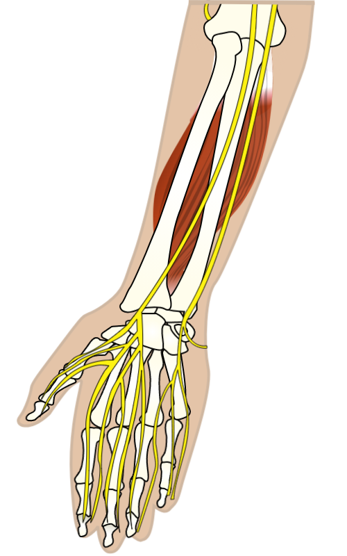 Why does my wrist hurt? — Physiotherapy London Ontario