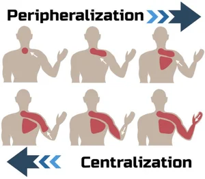What to do with a Shifted Spine — Physiotherapy London Ontario