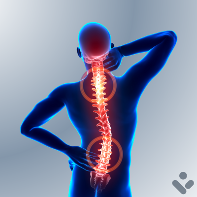 What to do with a Shifted Spine — Physiotherapy London Ontario