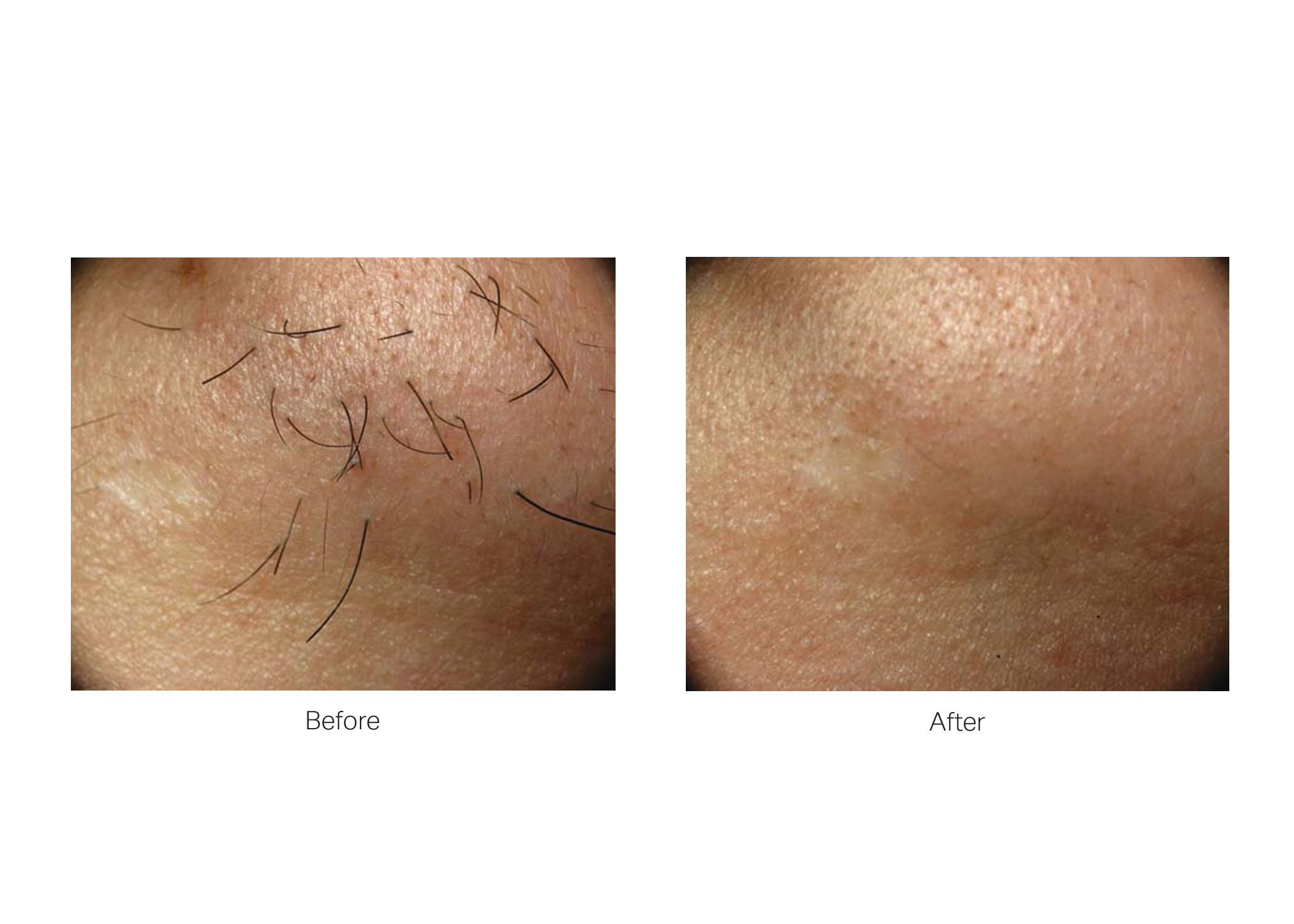 LipoMax Sculpt aesthetic body device — Estetique English