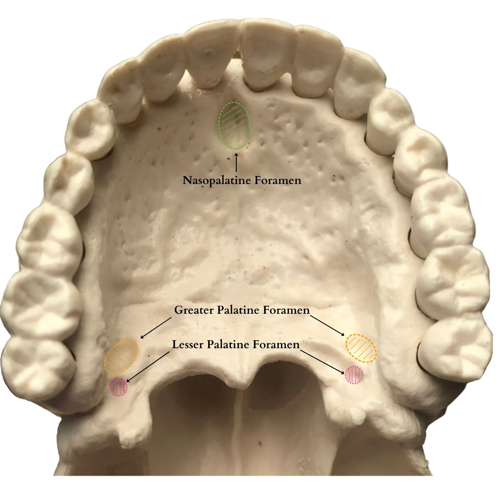 Pediatric Palatal Block — BABY BLOCKS