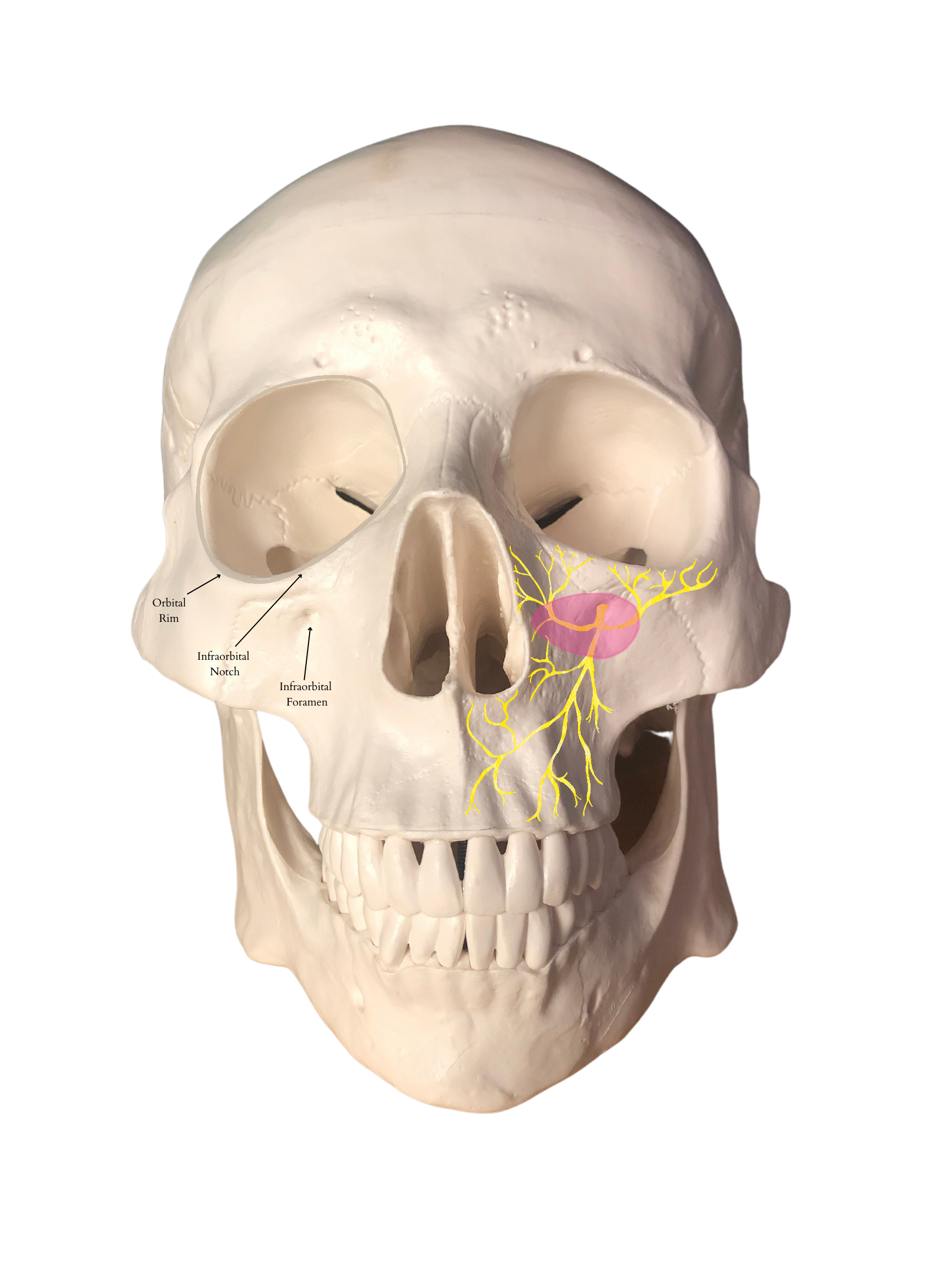 Infraorbital Nerve