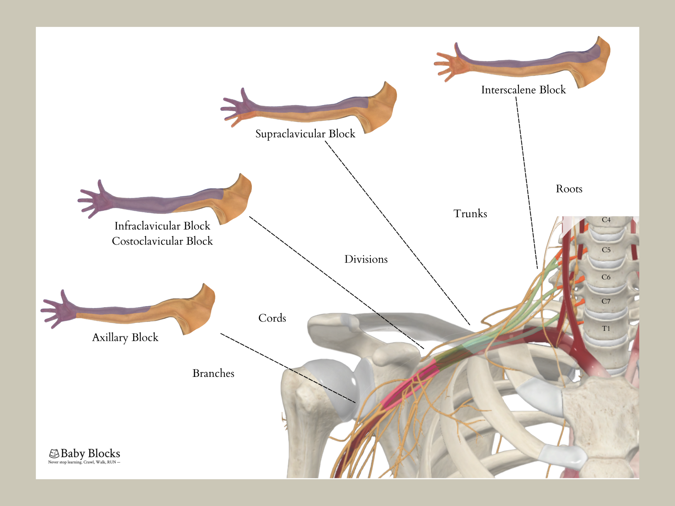 Upper Extremity Regional Nerve Blocks in Children — BABY BLOCKS