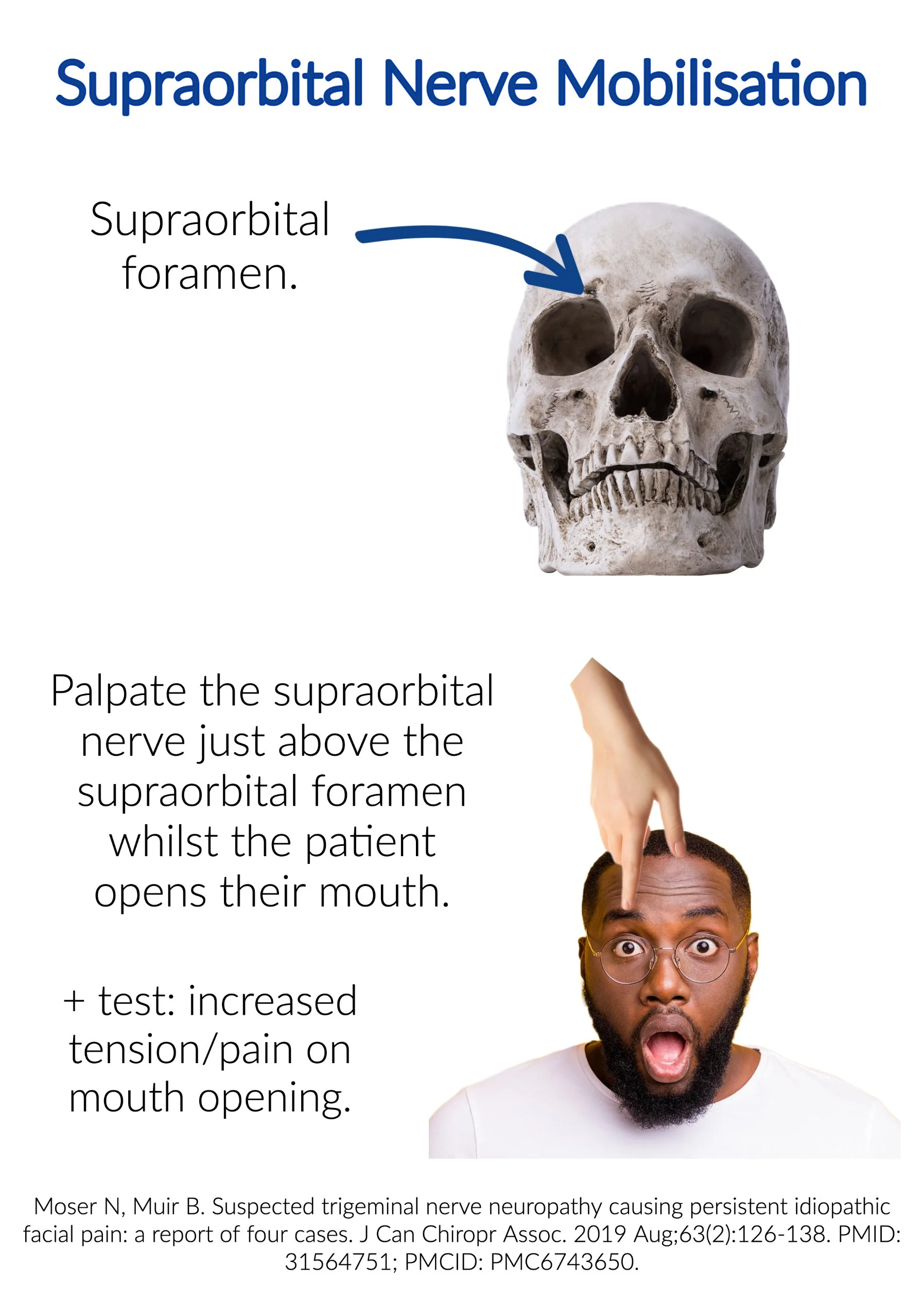 Neural mobilisation of the facial & cranial nerves — North Yorkshire ...