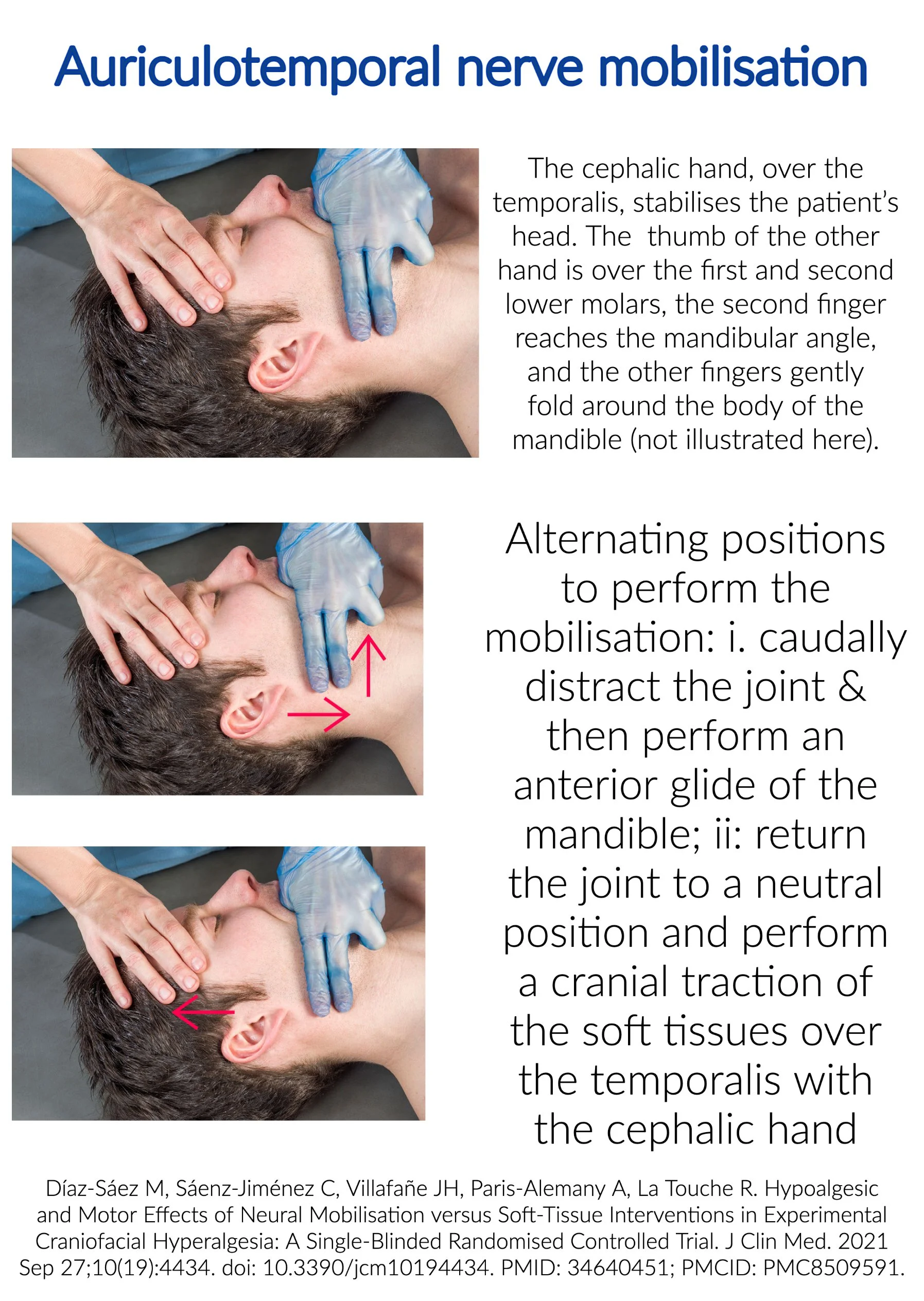 Neural mobilisation of the facial & cranial nerves — North Yorkshire ...