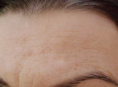 Skincare For Wrinkles And Dehydration Lines — Mindful Beauty