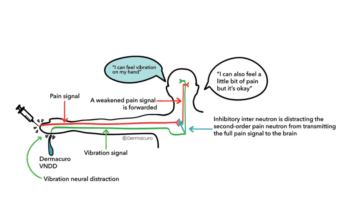 Dermacuro Pain Blocker