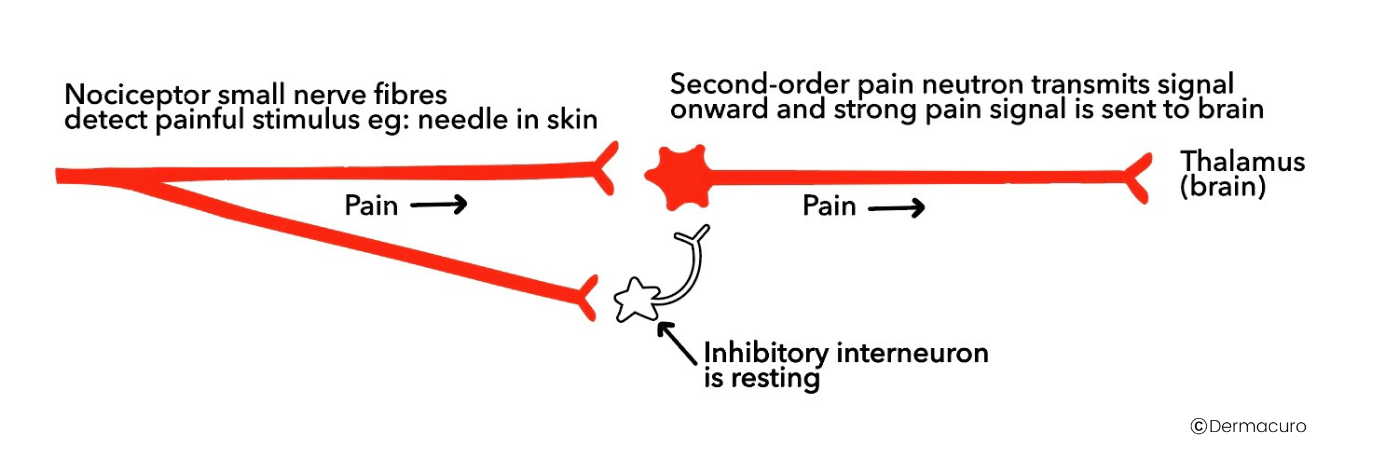 How to minimise pain, anxiety and discomfort for children having ...