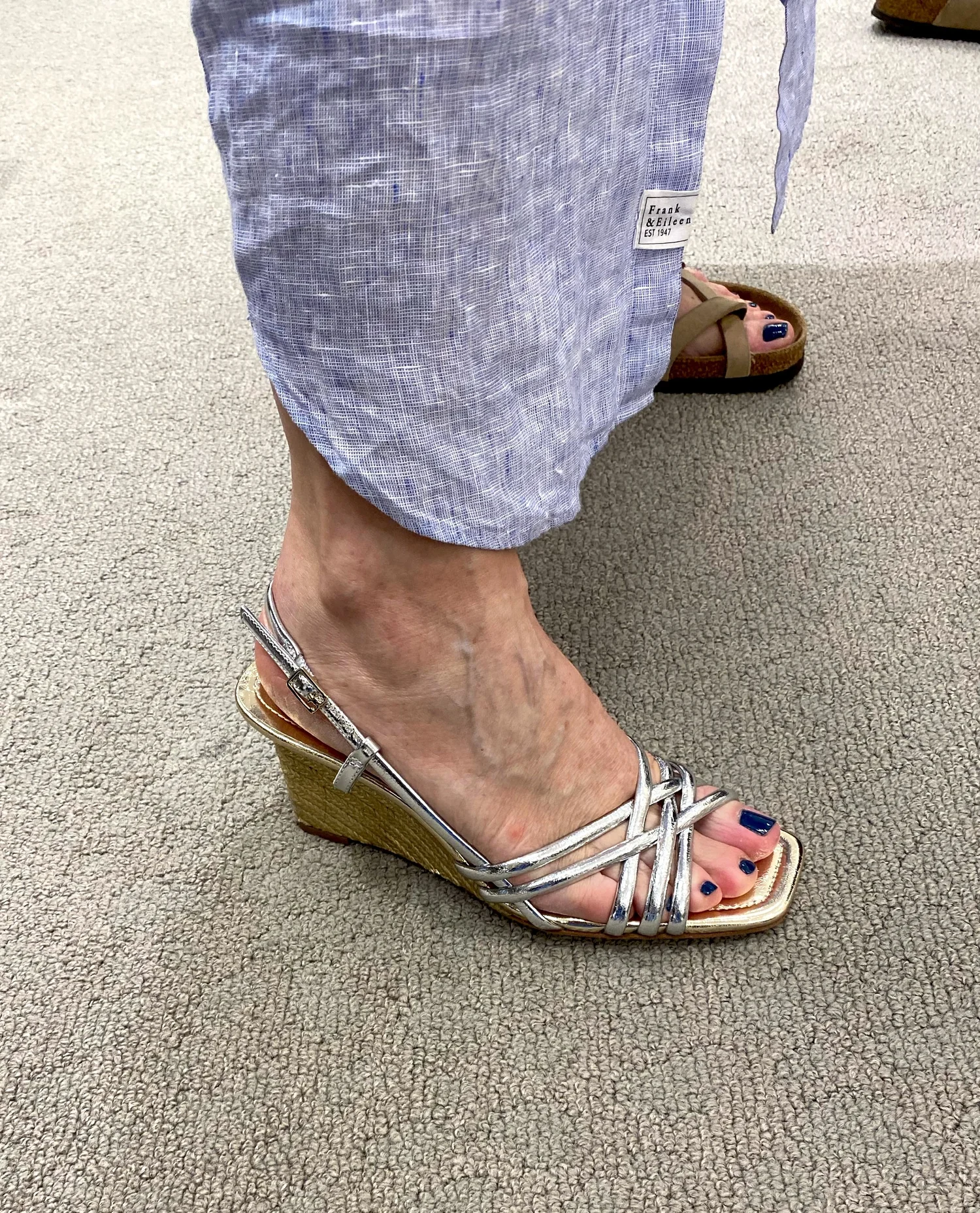 What Shoes To Wear with Summer Dresses: 2 Styles of Modern Wedges