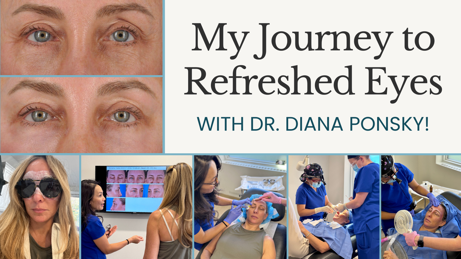 Eye Rejuvenation: My Experience with Facial Plastic Surgeon Dr. Diana ...