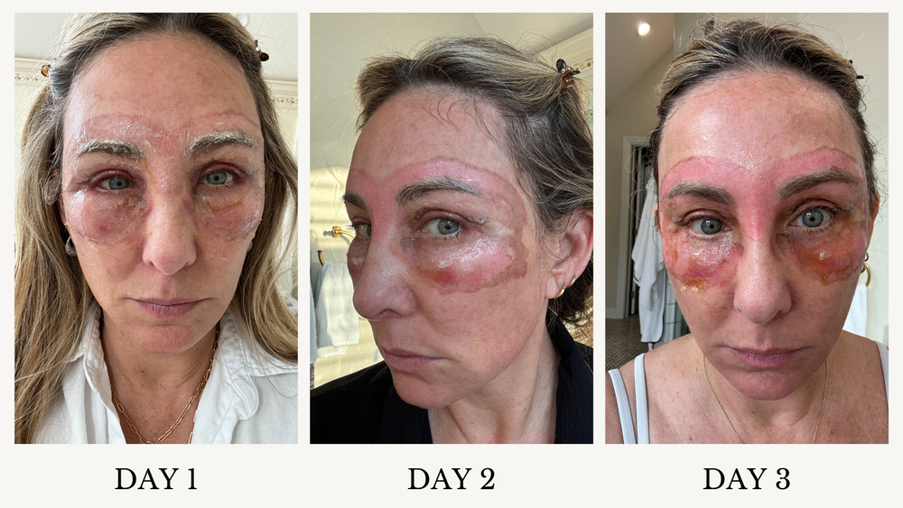 Eye Rejuvenation: My Experience with Facial Plastic Surgeon Dr. Diana ...